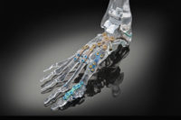 Exactech | Orthopaedic Implants | Joint Replacement