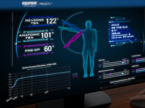 Active Intelligence | Exactech