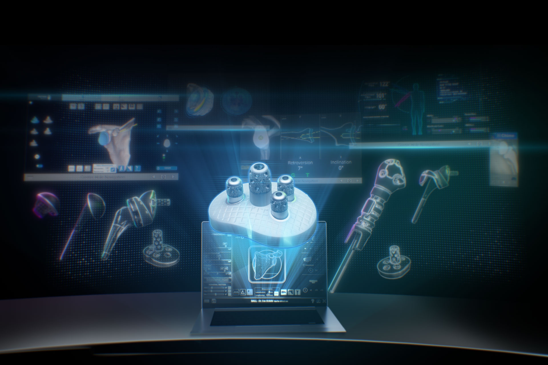 Pick Your Tech - Equinoxe Shoulder Laser Cage Glenoid | Exactech