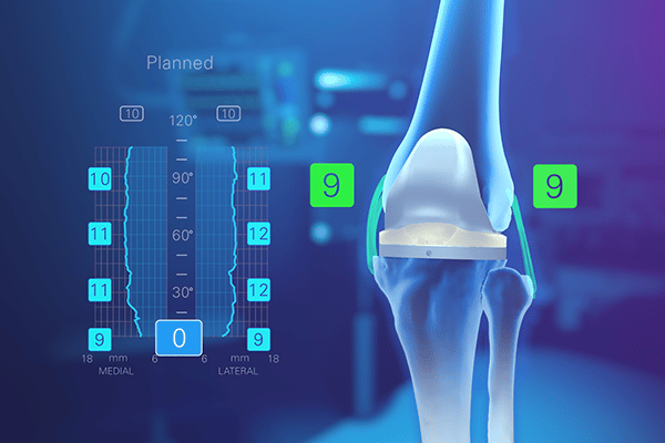 ExactechGPS Guided Personalized Surgery | Exactech