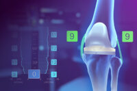 Exactech | Orthopaedic Implants | Joint Replacement