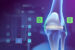 Exactech | Orthopaedic Implants | Joint Replacement