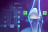 Exactech | Orthopaedic Implants | Joint Replacement