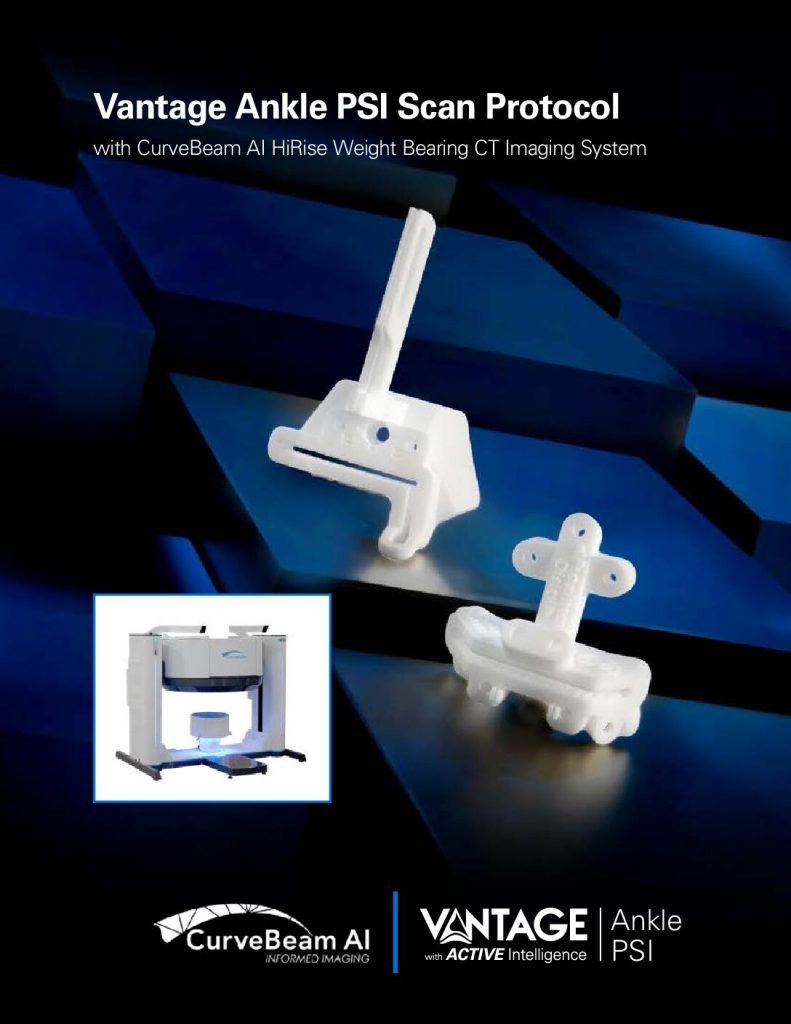 Vantage Ankle PSI CurveBeam HiRise Scan Protocol | www.exac.com