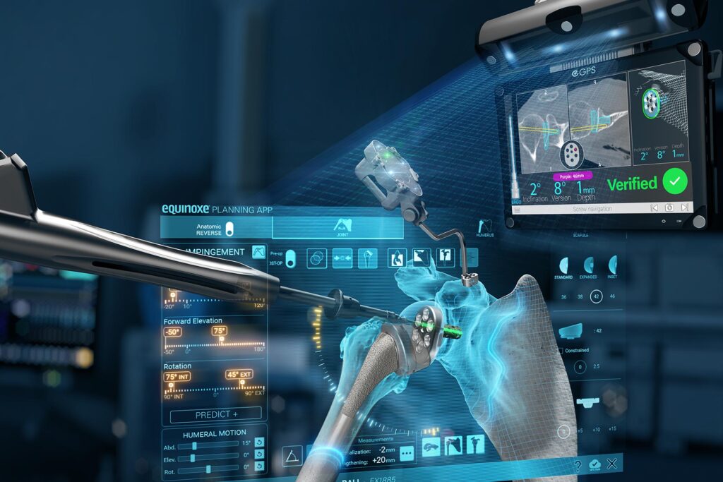 ExactechGPS Guided Personalized Surgery | Exactech