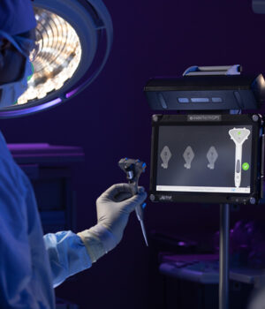 Exactech GPS Navigation | Active Intelligence Technology