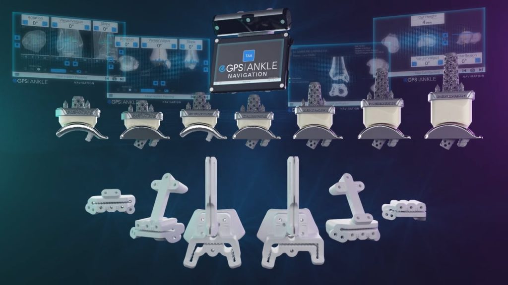 Exactech Vantage Ankle Continuum of Care | www.exac.com