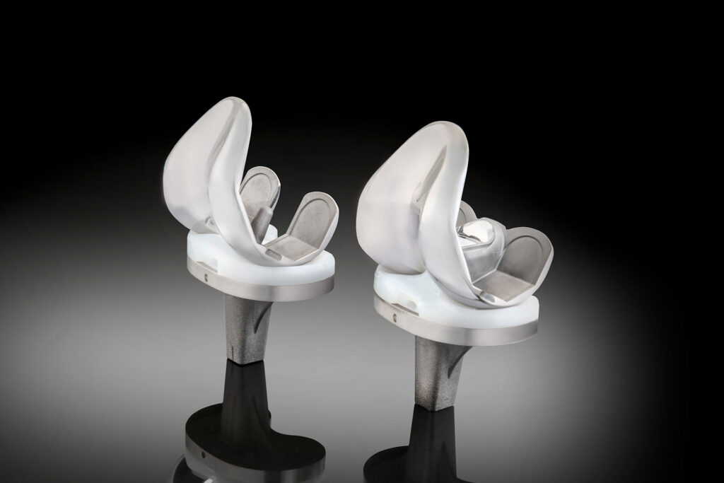 Truliant Primary Knee System | Knee Arthroplasty‎ | Exactech
