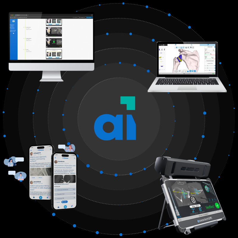 Start Using Exactech AI for Advanced Shoulder Surgery | www.exac.com
