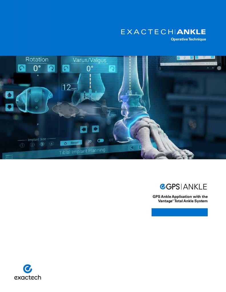 GPS Ankle Application Archives | www.exac.com