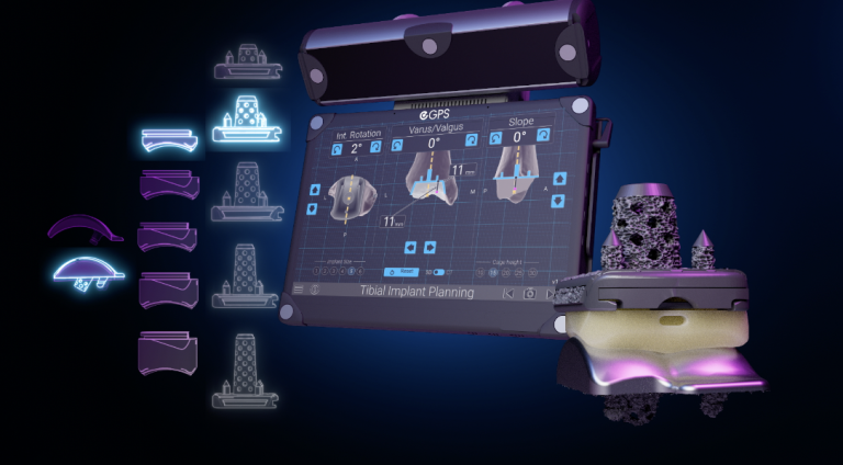 GPS Ankle | Navigation in Total Ankle Arthroplasty | Exactech